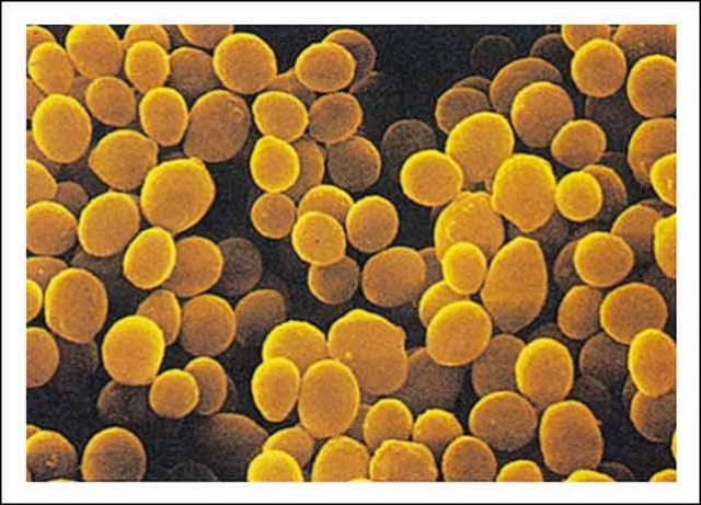 Micrococcus sp. | KÖRnyezetvédelmi INFOrmáció