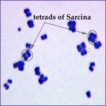Sarcina sp. | KÖRnyezetvédelmi INFOrmáció