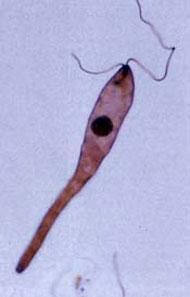 Heteromita globosa | KÖRnyezetvédelmi INFOrmáció